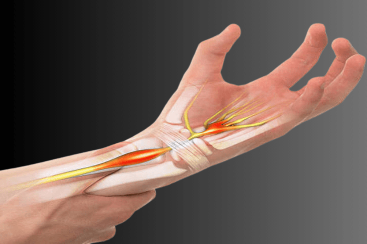 Best Hand Tendinopathy Treatment in Ahmedabad
