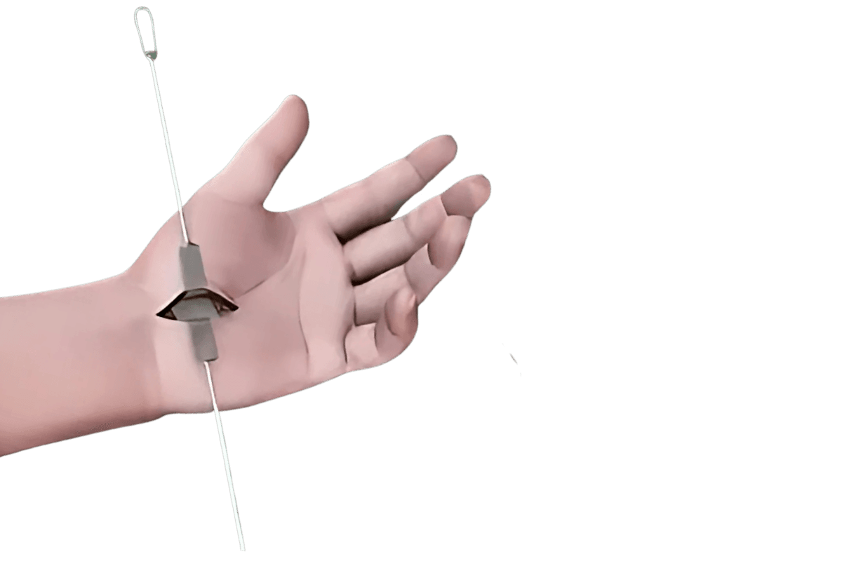 Best Orthopedic Hand Surgery in Ahmedabad