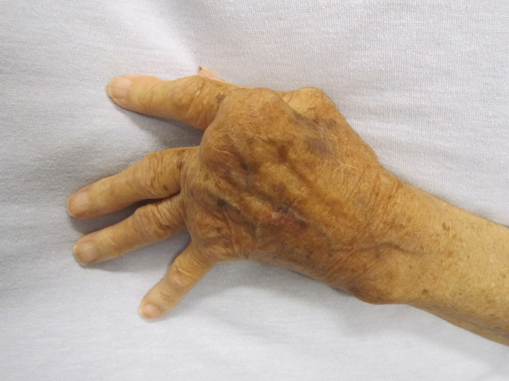 When Finger Pain Is Serious: 8 Warning Signs You Must Not Ignore