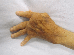 When Finger Pain Is Serious: 8 Warning Signs You Must Not Ignore