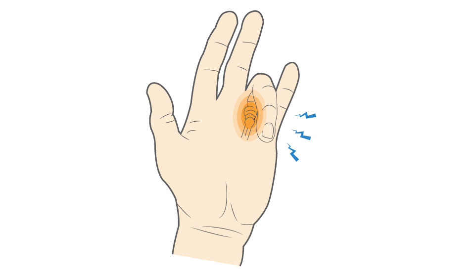 When Finger Pain Is Serious: 8 Warning Signs You Must Not Ignore