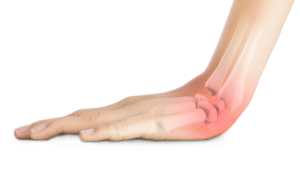Soft Tissue Injuries of the Hand: Signs, Risks & Treatment