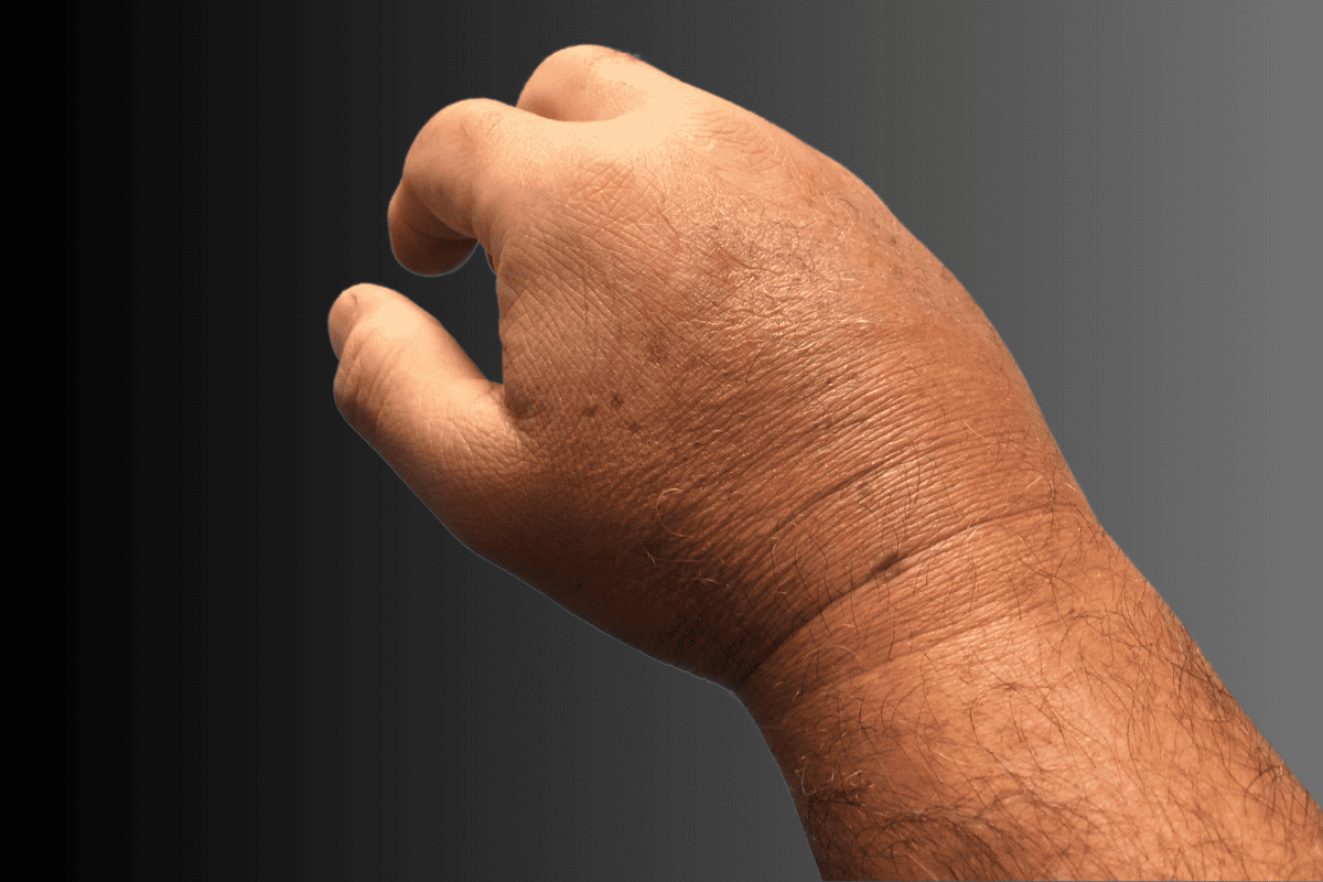 Best Hand Surgeon in Ahmedabad | Dr. Karn Maheshwari — Krisha Hospital