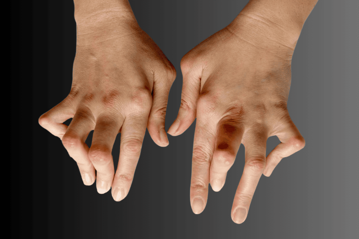Best Hand & Wrist Surgery in Ahmedabad: Krisha Hand Hospital